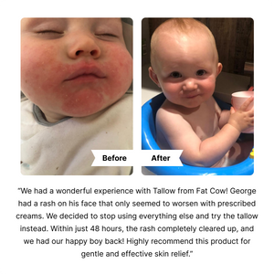 Best Grass-Fed Beef Tallow Skin Care Products – Fat Cow Tallow Skincare